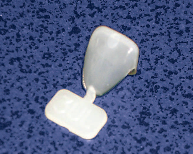 EZ-CROWN - Anterior Kit – Efficient Dental Technologies