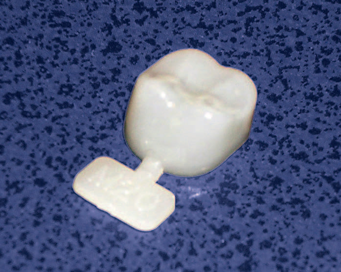 EZ-CROWN - Complete Molar Kit – Efficient Dental Technologies